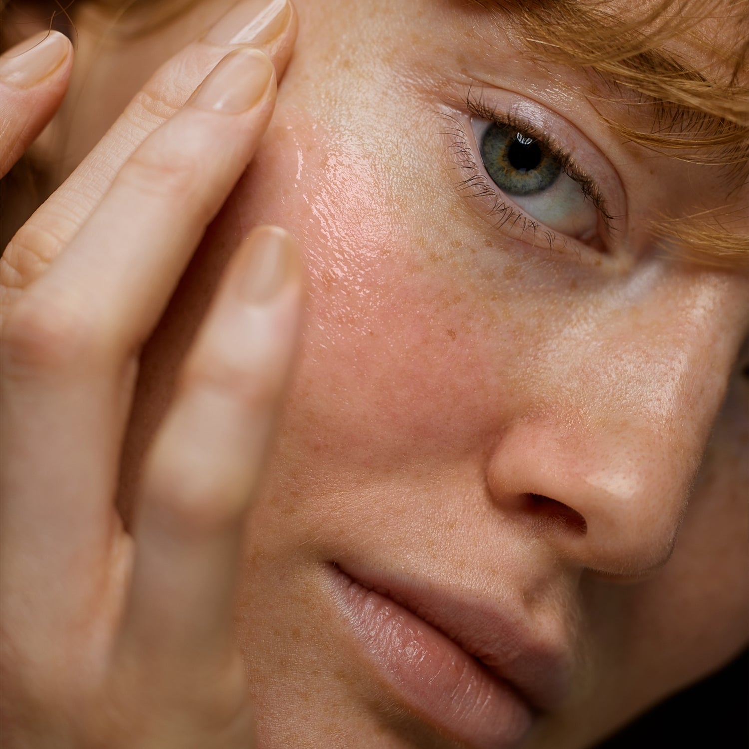 Rosacea og Perioral Dermatitis: Symptomer og Behandling – woods_ copenhagen